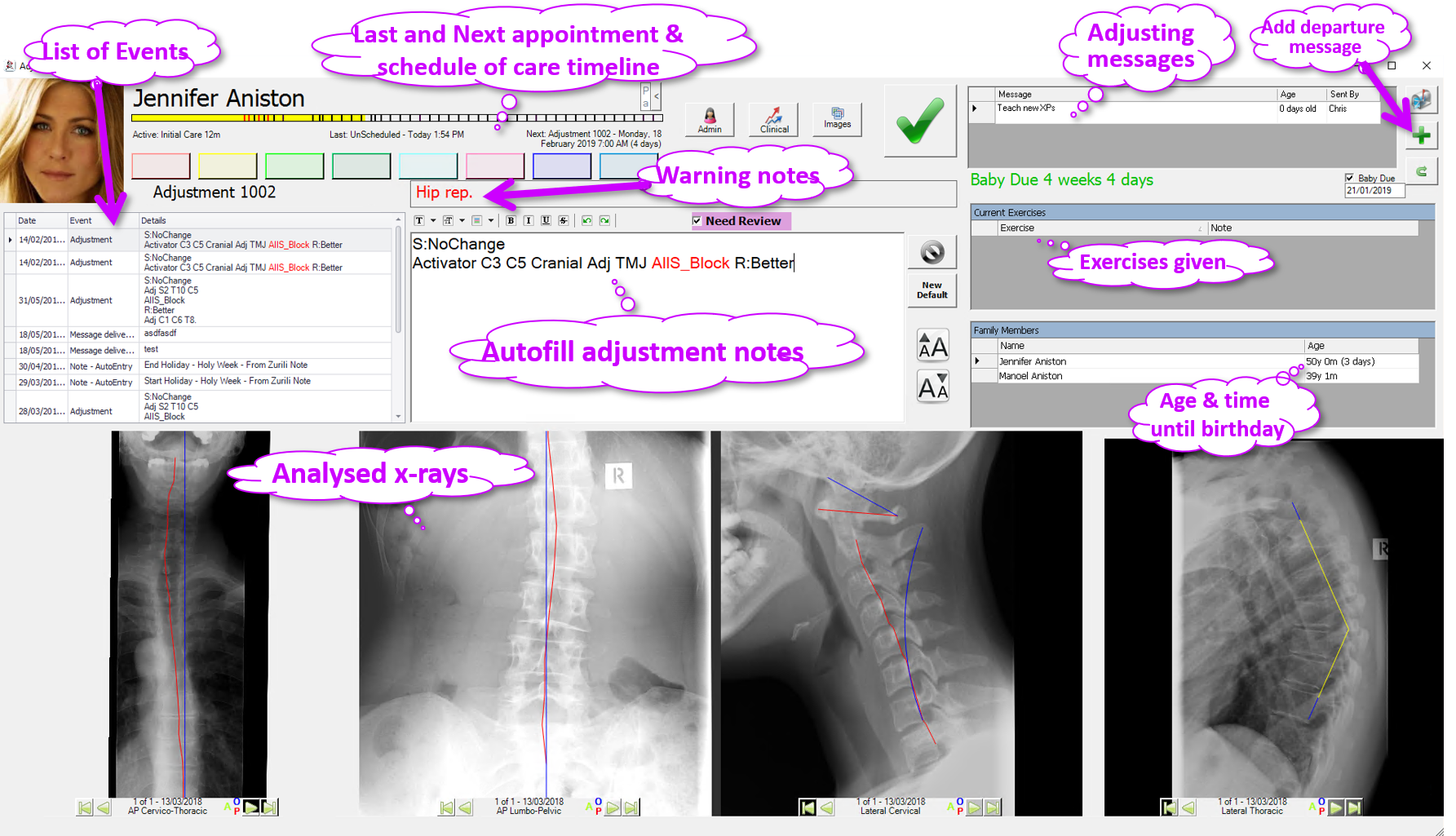 Bring the ‘just’ back to adjusting – Spinalogic