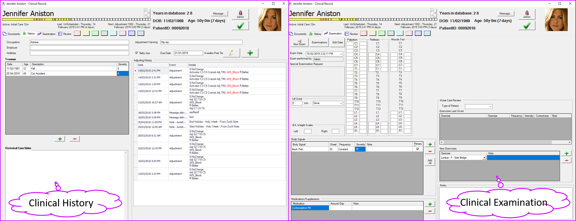 Bring the ‘just’ back to adjusting – Spinalogic